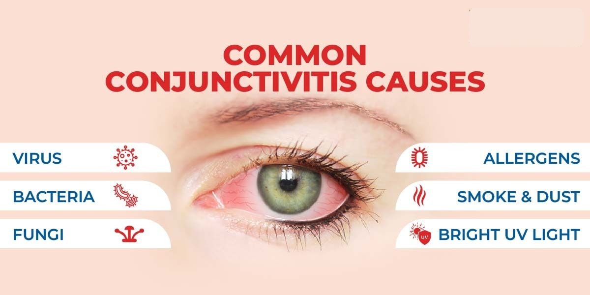 Conjunctivitis Guide: Expert Eye Clinic in Faridabad